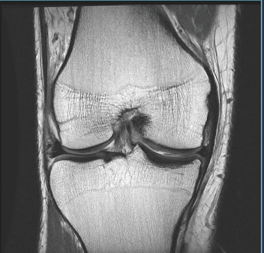 Arthrogram Joint Imaging • American Health Imaging • MRI • CT