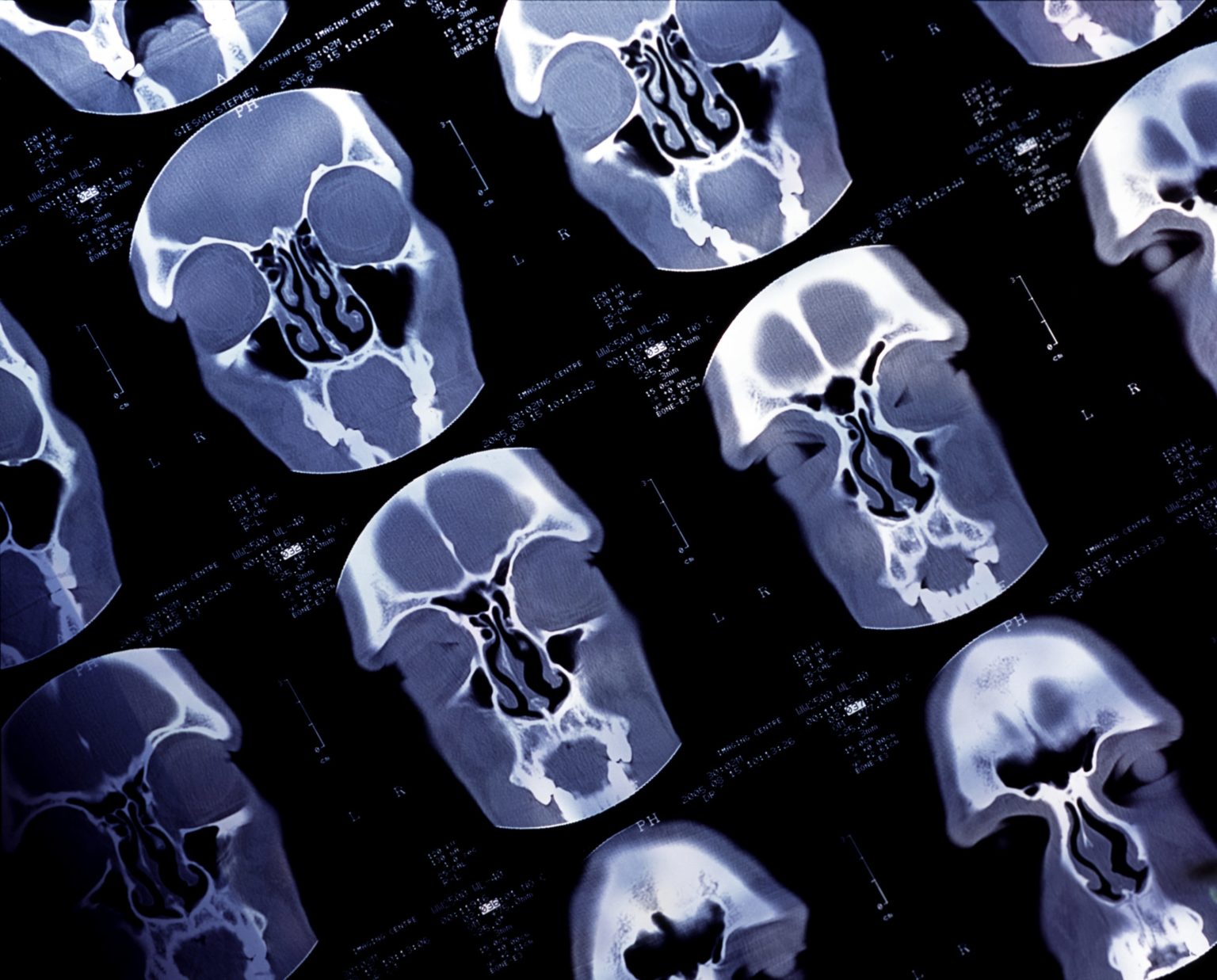 CT Imaging • American Health Imaging