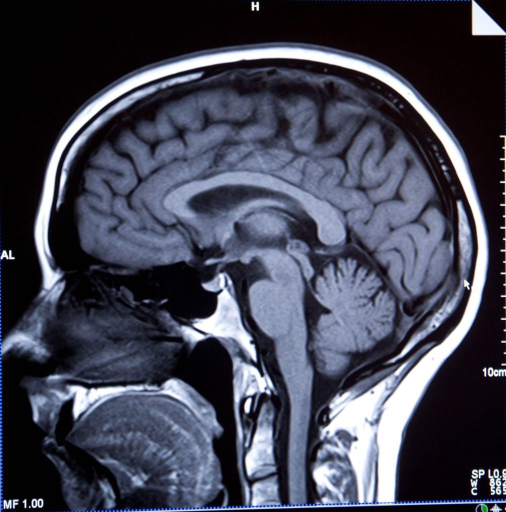 MRI Imaging Scans • American Health Imaging