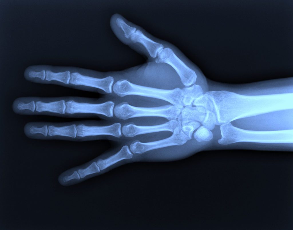 Digital X-Ray • American Health Imaging • Walk-In X-Rays Welcome